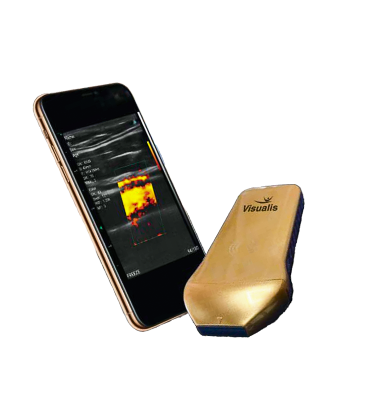 Visualis - Ultrasonido portátil de Alta Definición